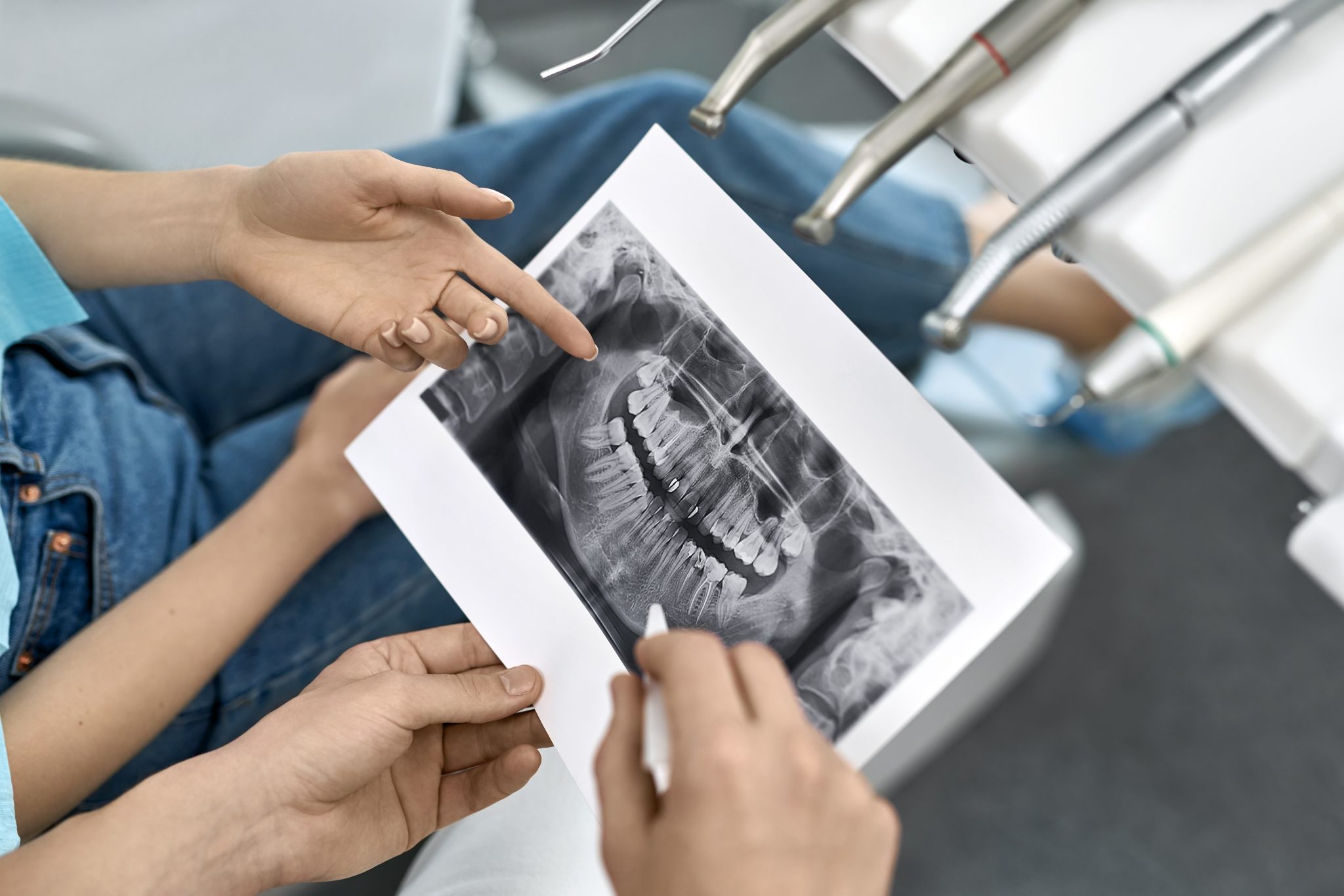 What Does OPG Mean In Dentistry Dental Equipment Services