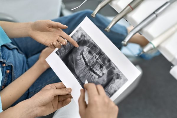 What Does OPG Mean In Dentistry? | Dental Equipment Services